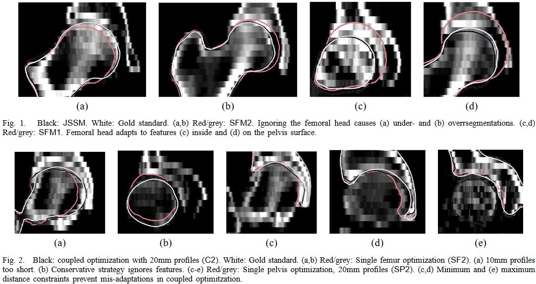 An Articulated Statistical Shape Model For Accurate Hip Joint