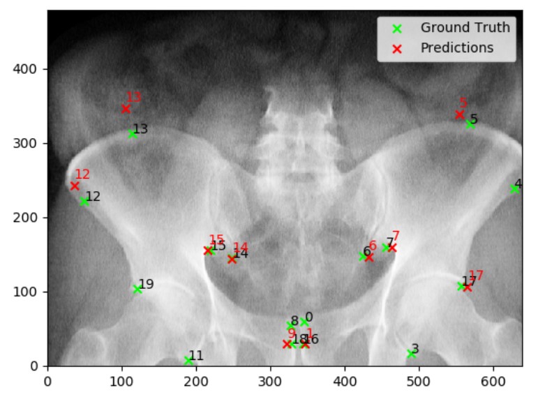 Anatomical Landmark Detection From X Ray Images Using Convolutional Neural Networks Hans Lamecker