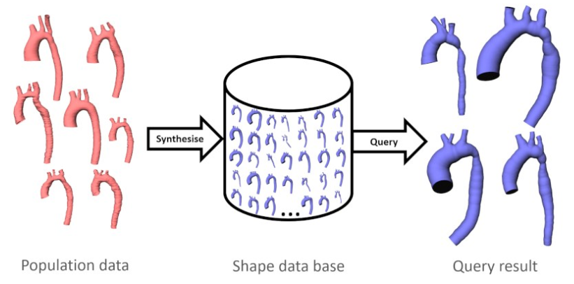 Aortic Shape Synthesiser - Understanding Anatomical Variations of the ...