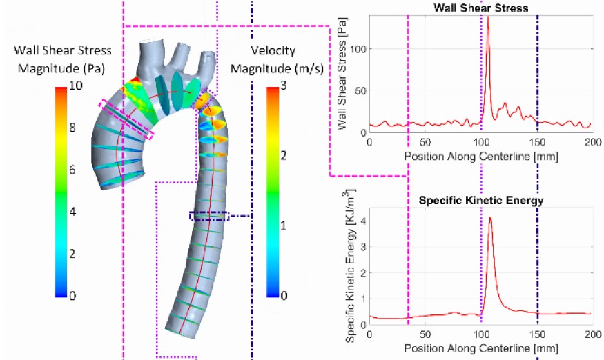 Deep Learning Based Centerline Aggregated Aortic Hemodynamics An