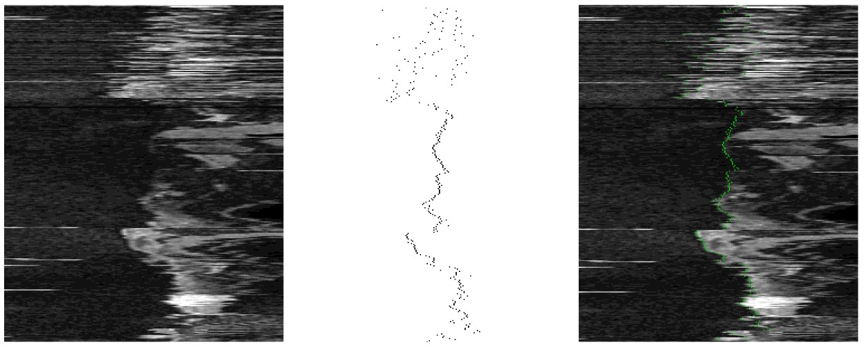 Deep Learning For Boundary Detection In Model Based Segmentation Hans
