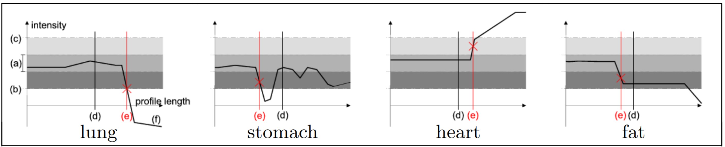 Shape Constrained Automatic Segmentation Of The Liver Based On A