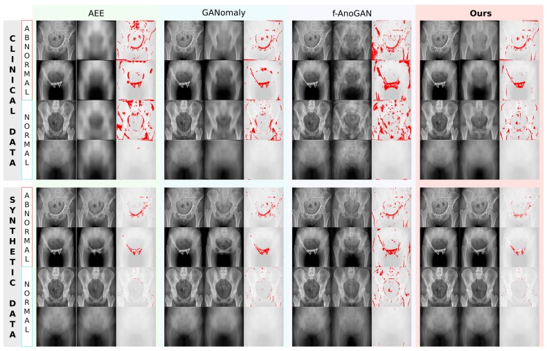 Unsupervised Detection Of Disturbances In 2d Radiographs Hans Lamecker